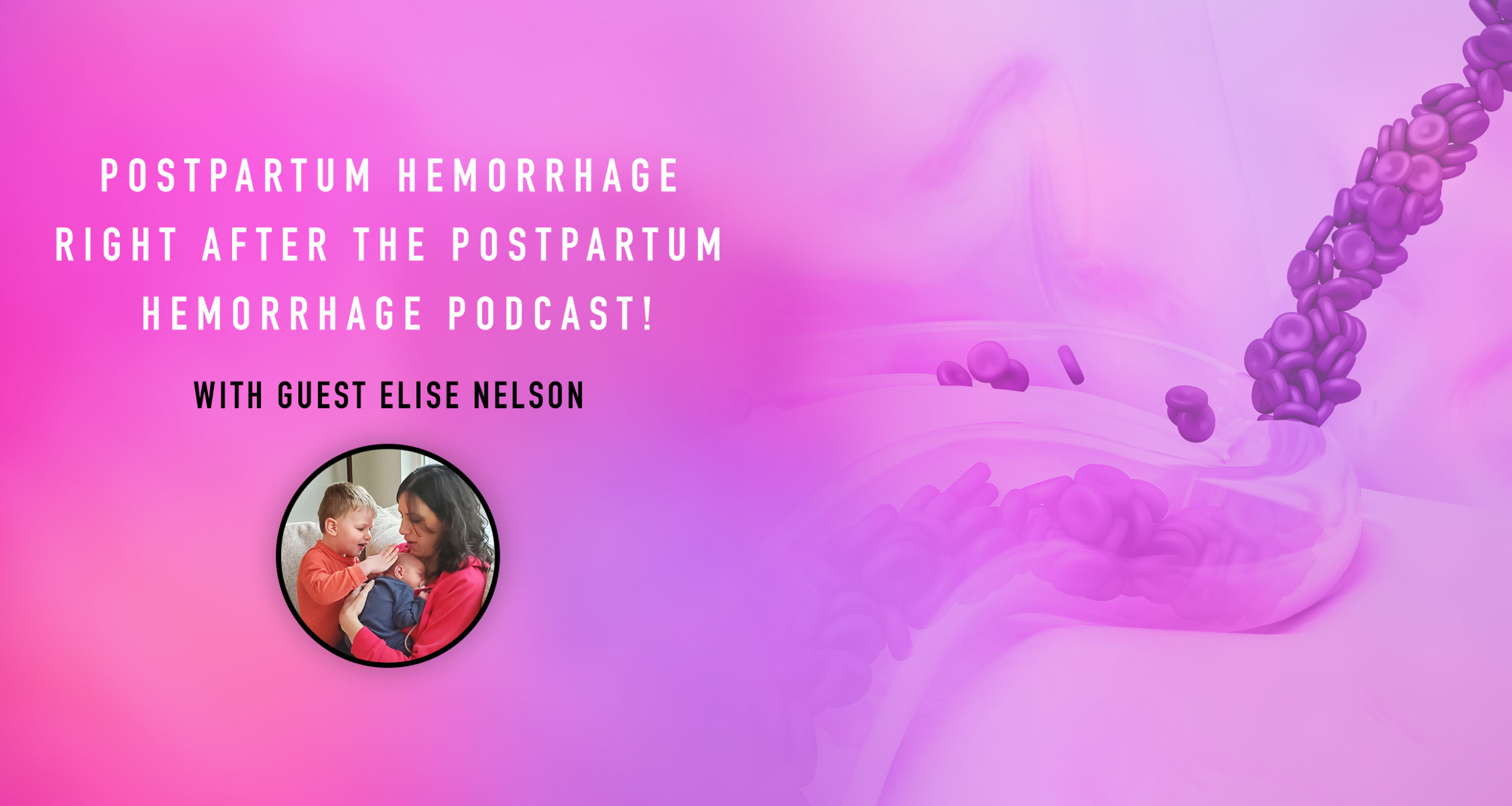 “Postpartum Hemorrhage right after the Postpartum Hemorrhage Podcast ...